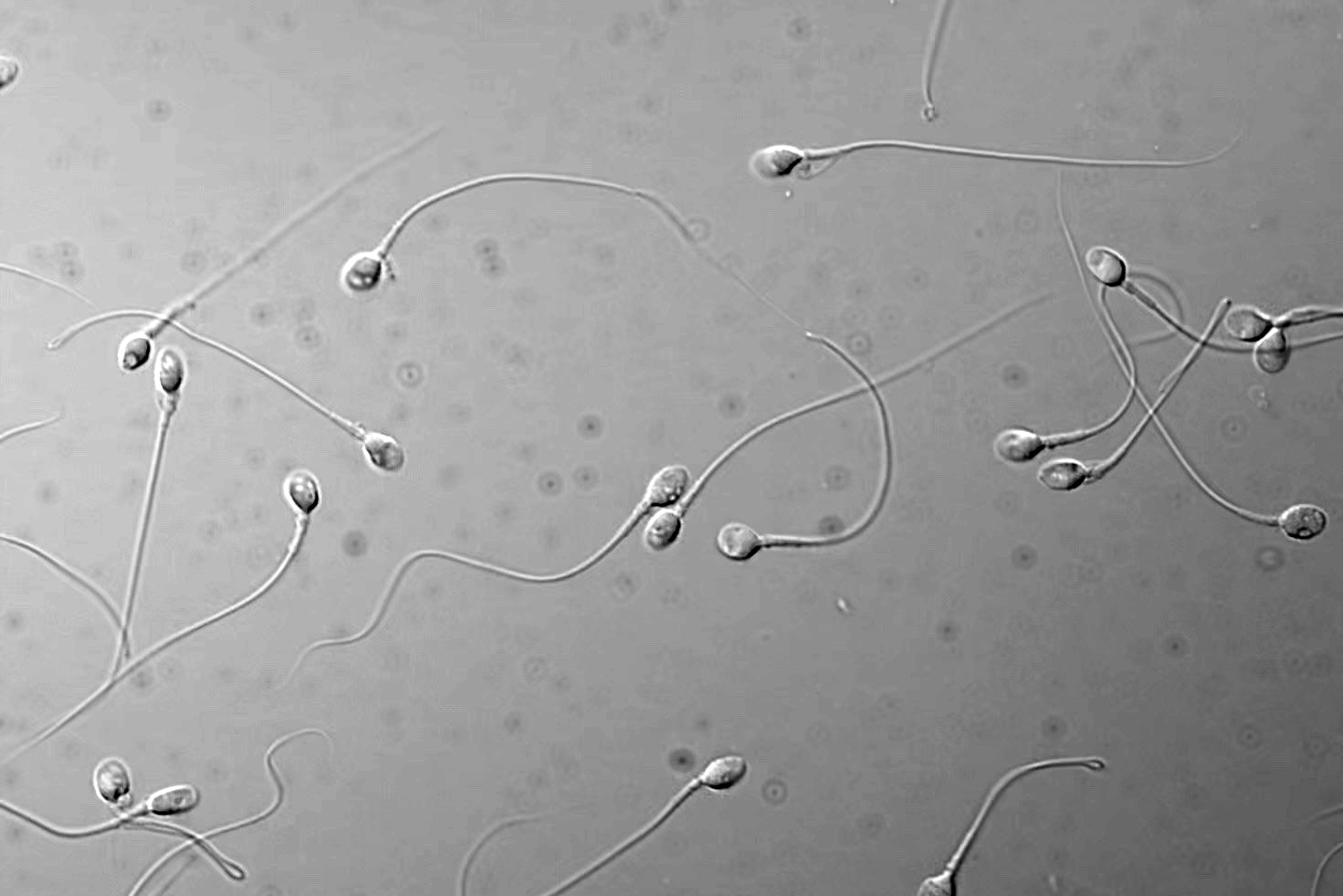 Sperm's creative approach to genome packing | Research Institute of ...